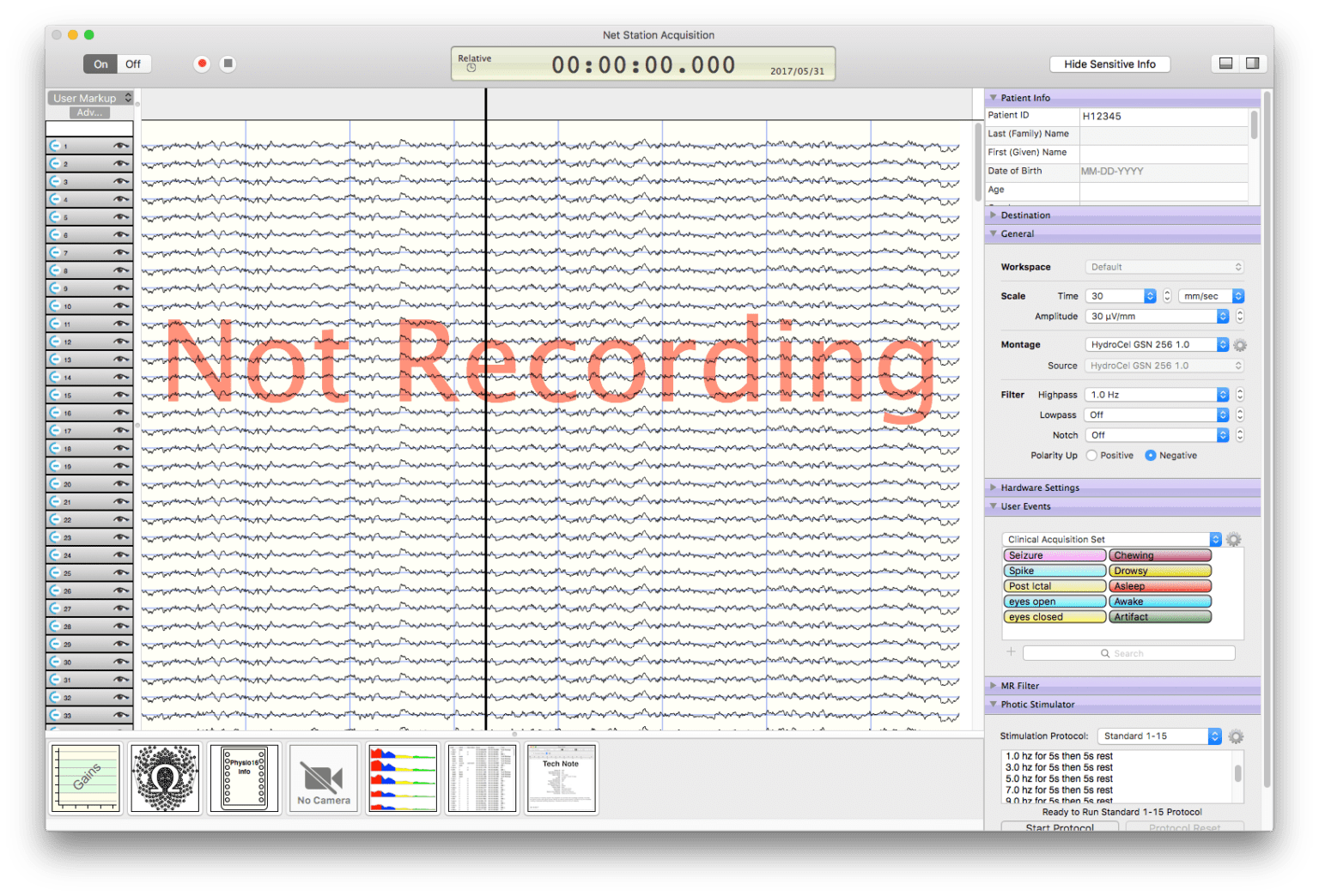 How to Start and Stop a Session in Net Station Acquisition - Magstim