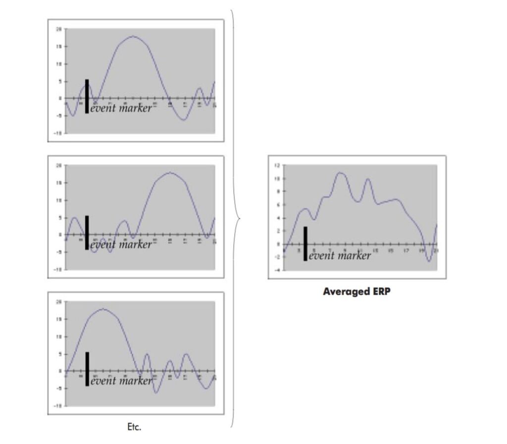 Basic Timing Principles - Magstim