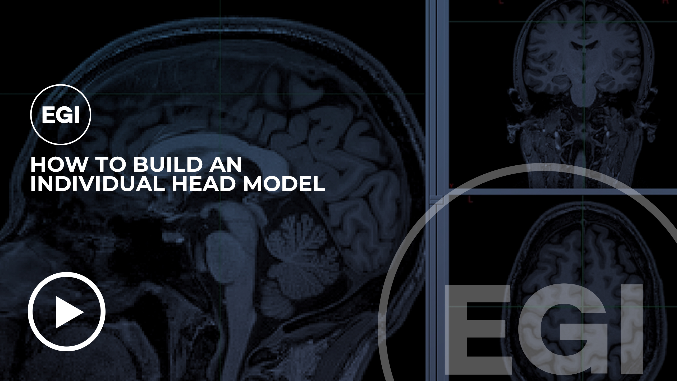 How to build an Individual Head Model (IHM): Video Tutorial - Magstim